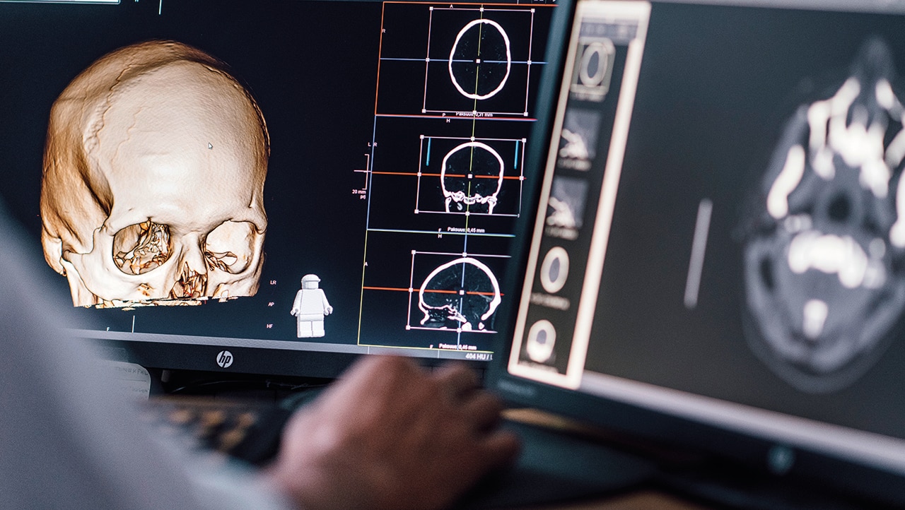 AI Head Analysis | CGI.com