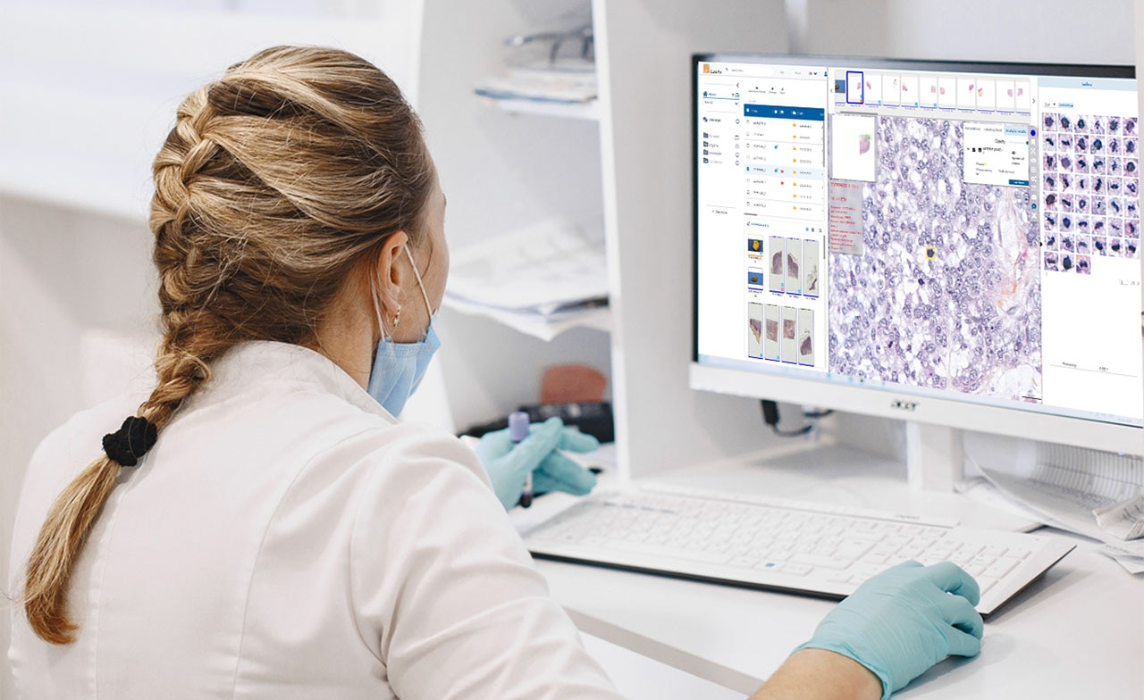 CGI og Tribun Health valgt som leverandør af digital patologi i Region ...