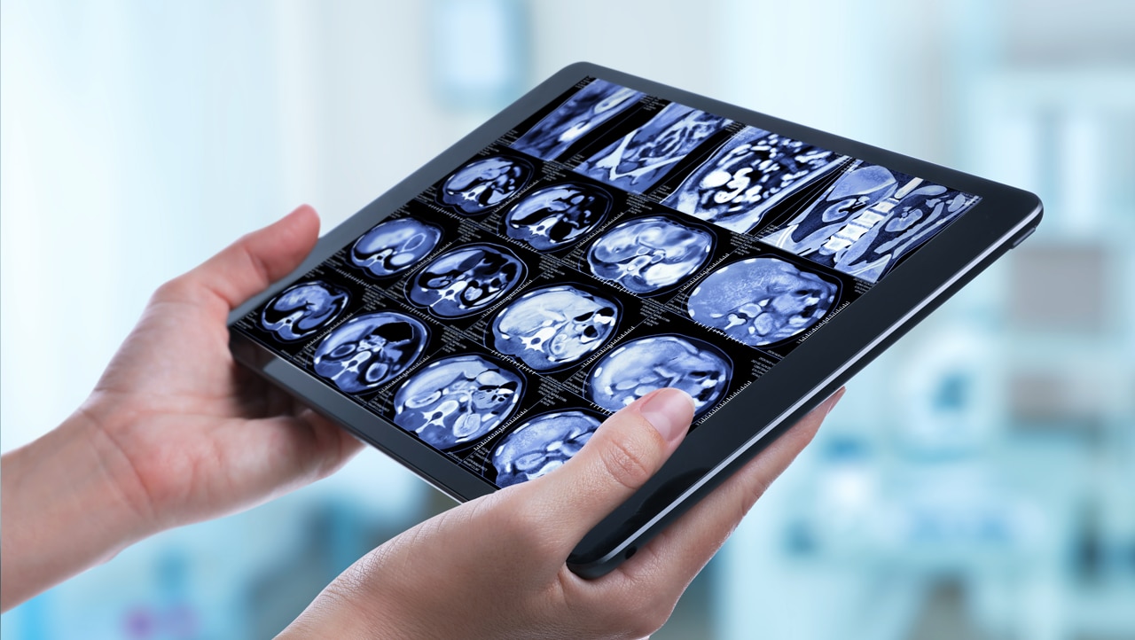 Bedrijfsharmonisatie door één corporate SAP-systeem | CGI NL